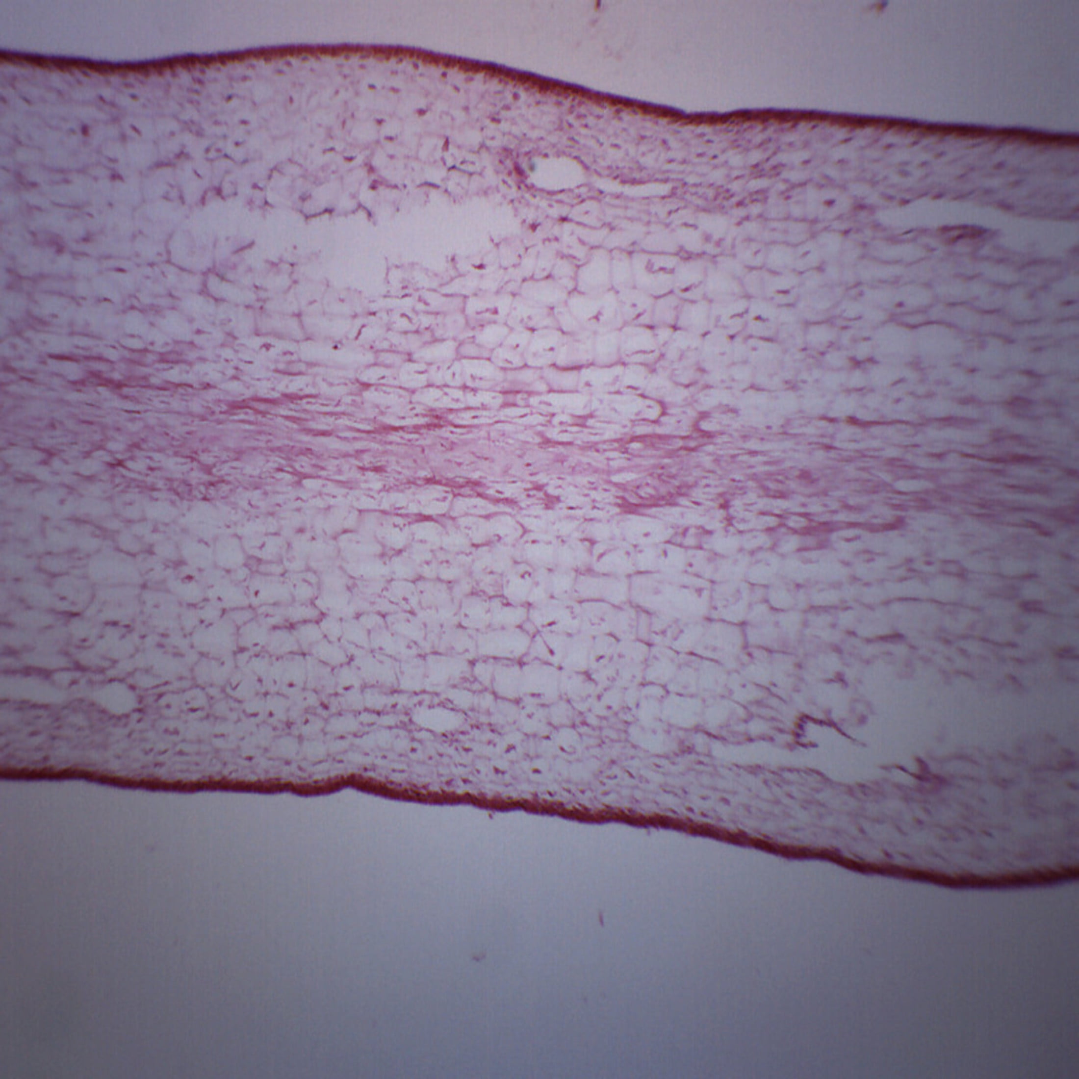 Protista Laminaria - Cross Section - Prepared Microscope Slide - 75 x ...