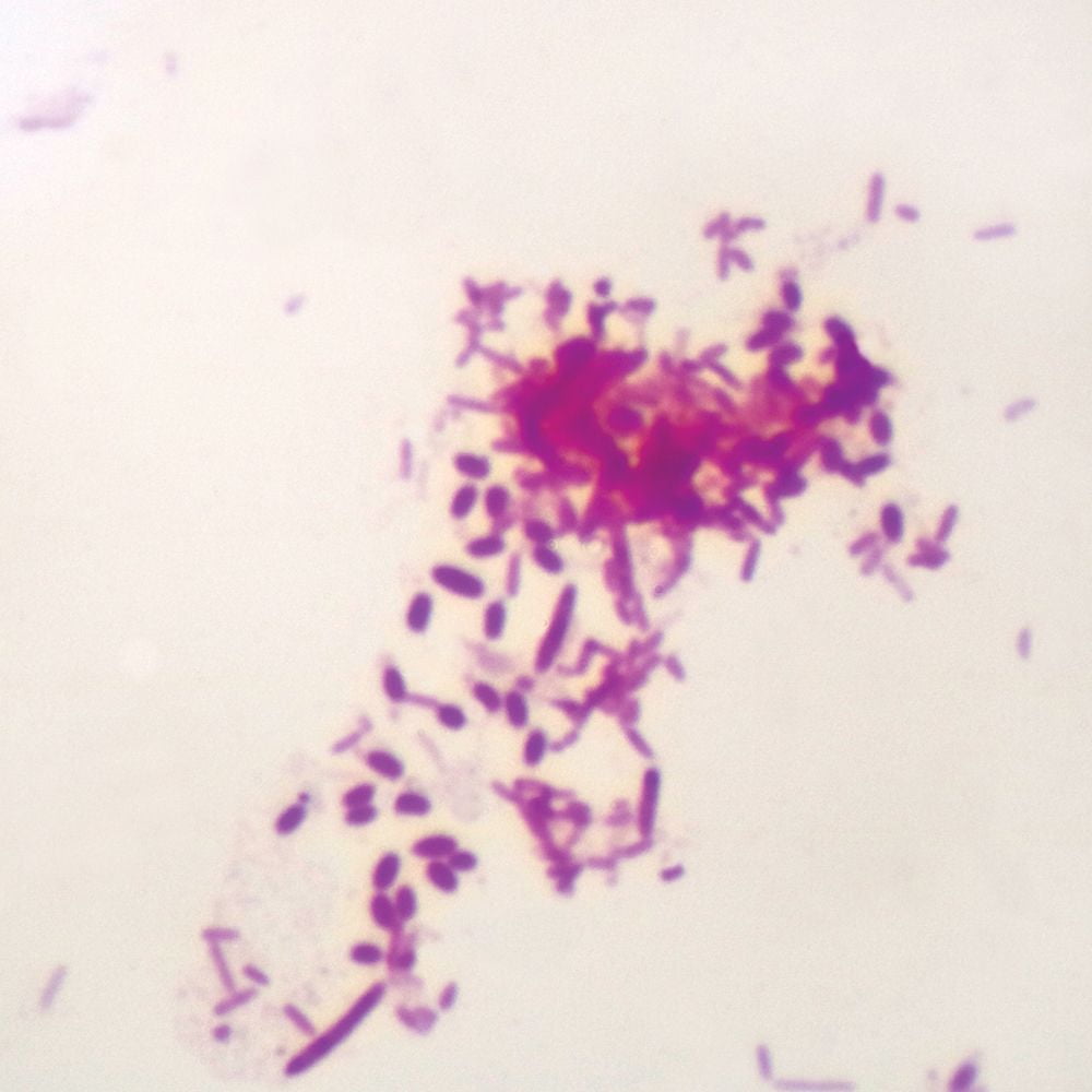 Pseudomonas Aeruginosa, W.M. Microscope Slide - Walmart.com