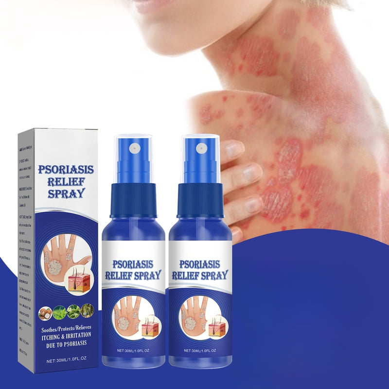 Psoriasis Relief Spray, Psoriasis Anti Itch Spray,For Severe Eczema and ...