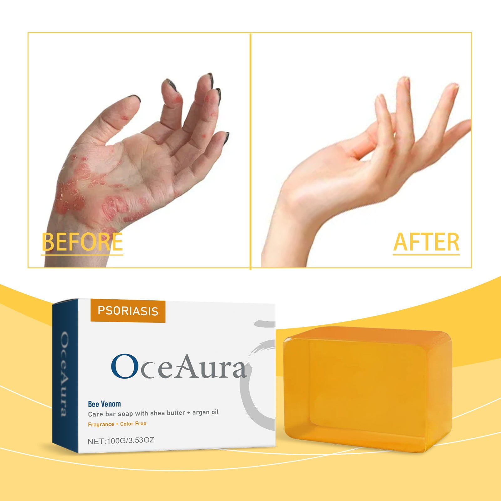 Psoriasis Soap With Argan Oil & Shea Butter| Color Free, Psoriasis Soap ...