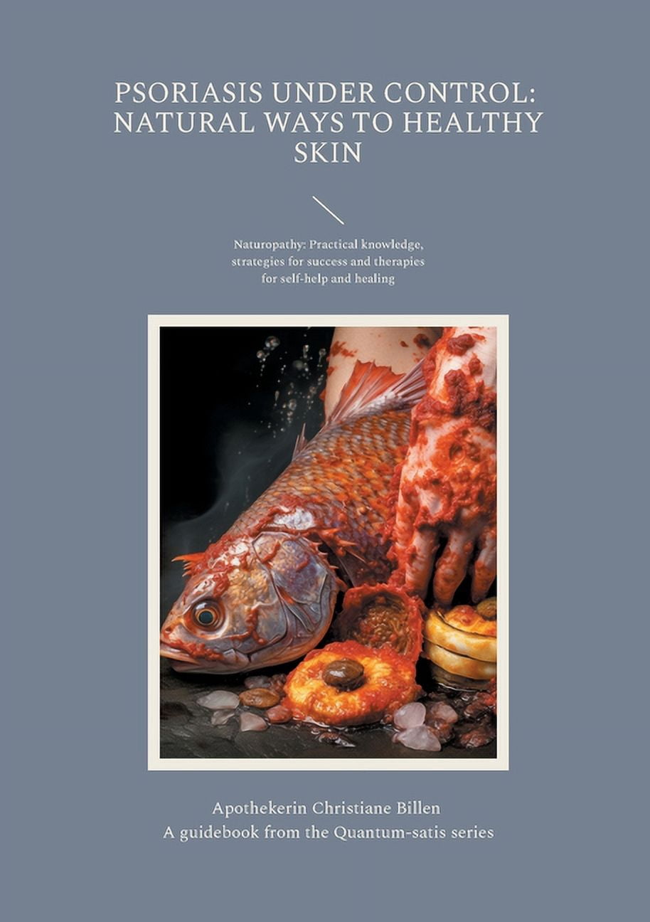 Psoriasis under control: Natural ways to healthy skin: A guidebook from ...