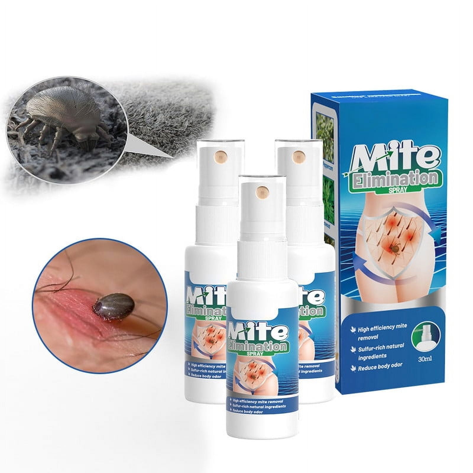 Pubic Lice Mites Spray For Kids &Adult-Antibacterial Spray-Mite Removal ...