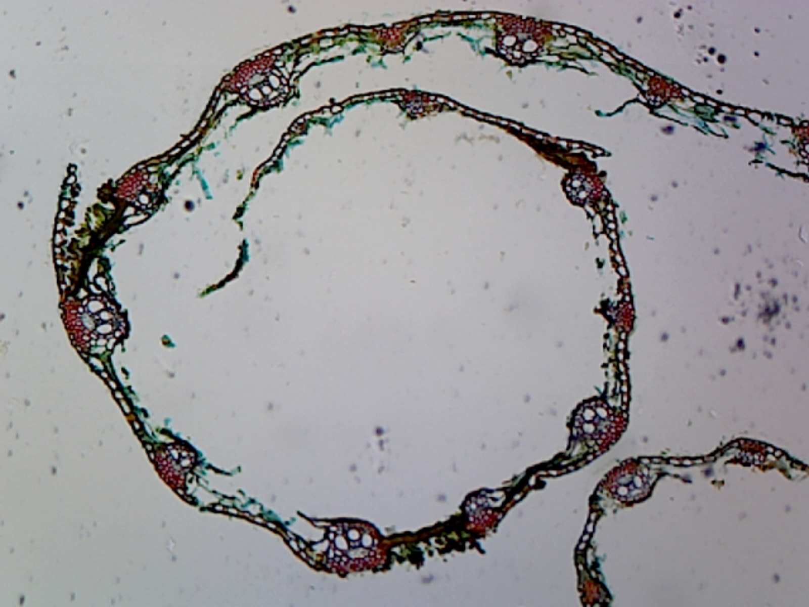 Puccinia Graminis Uredinia (Basidiomycetes); Section by Go Science ...