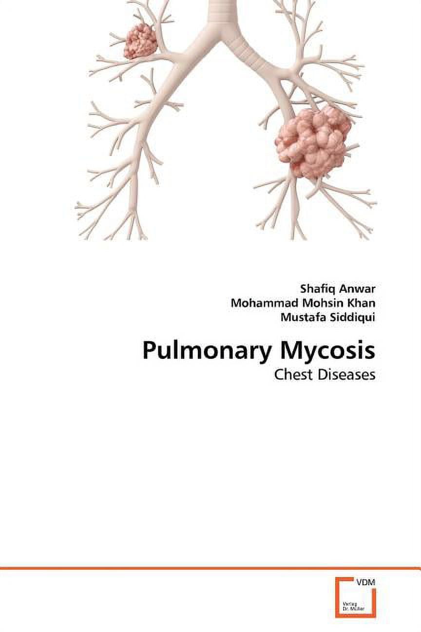 Pulmonary Mycosis (Paperback) - Walmart.com