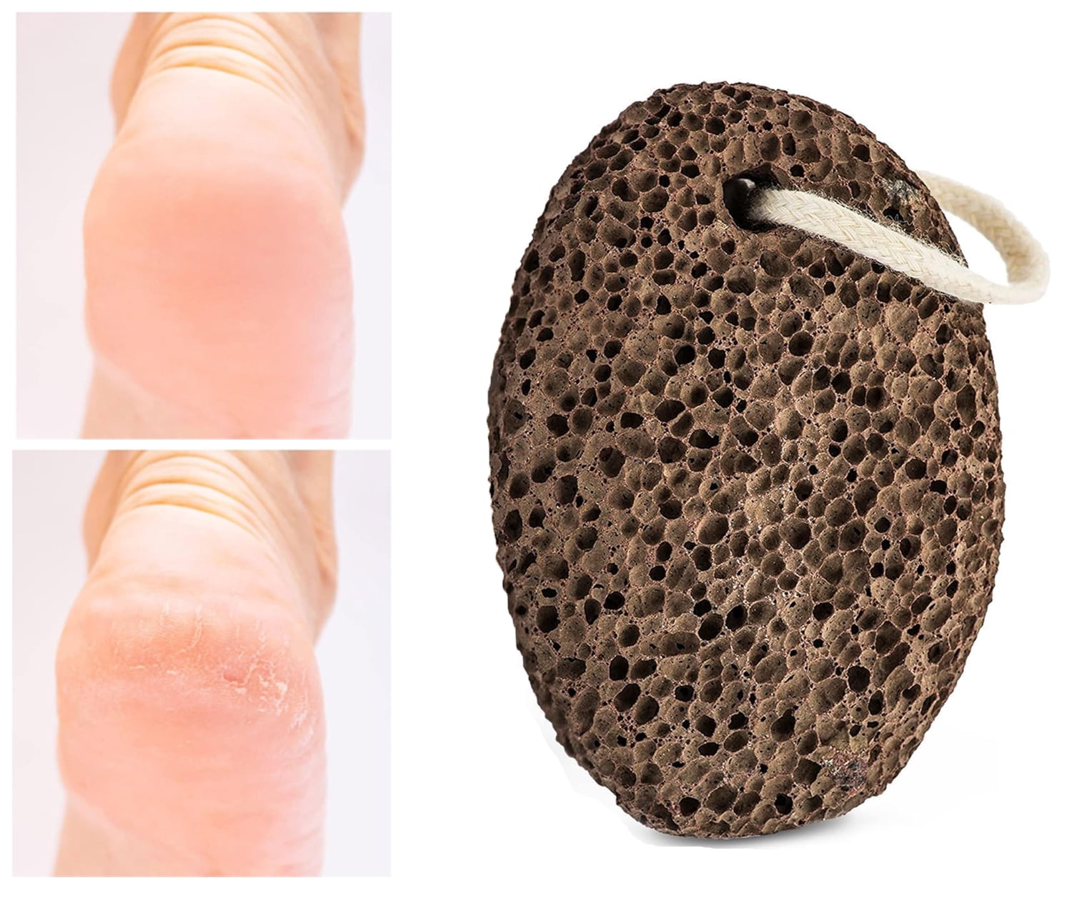 Pumice Stone for Feet Callus Remover (1Pc) - Foot Pumice Stone for ...