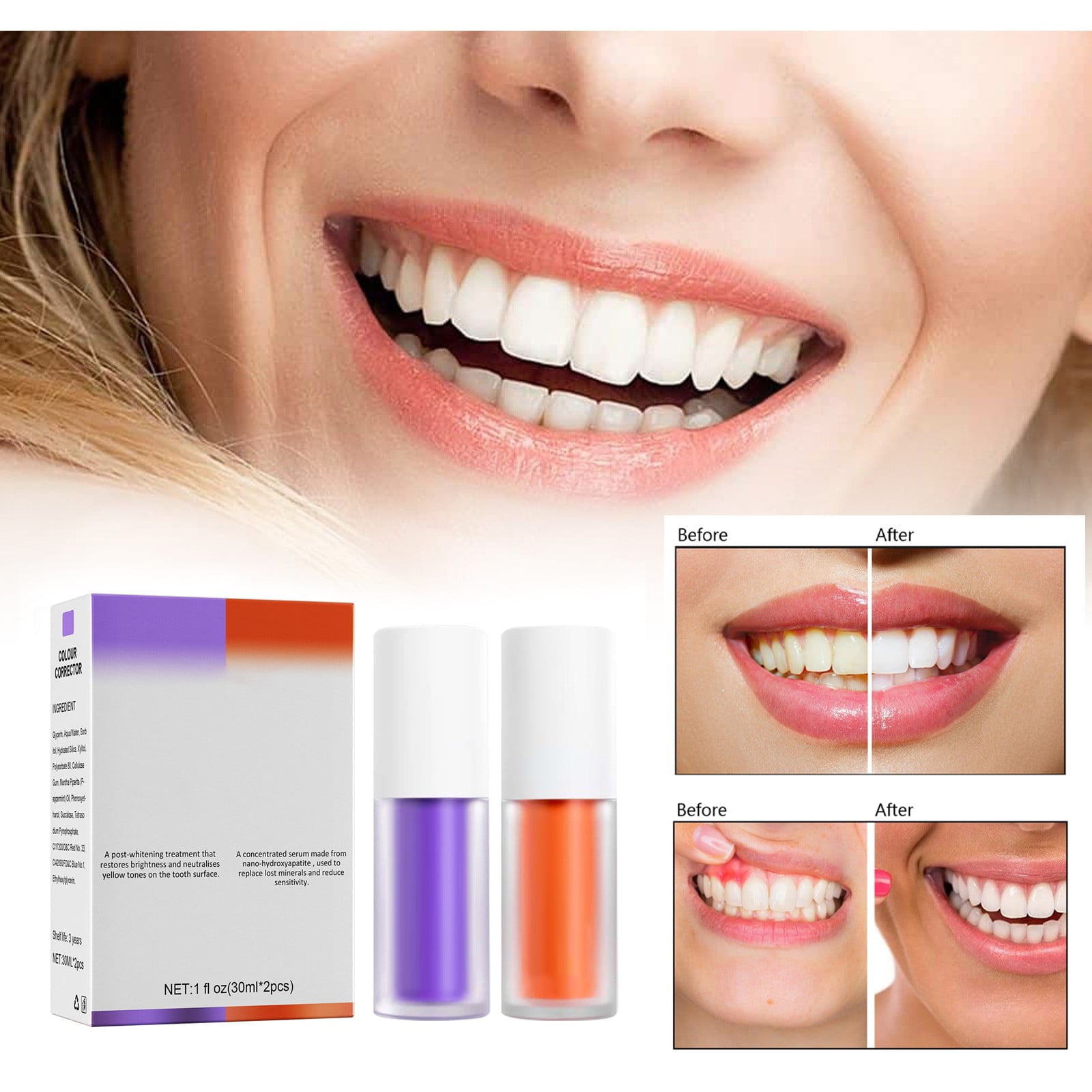 Purple Teeth Tooth Stain Removal Teeth Booster Purple Toothpaste Colour ...