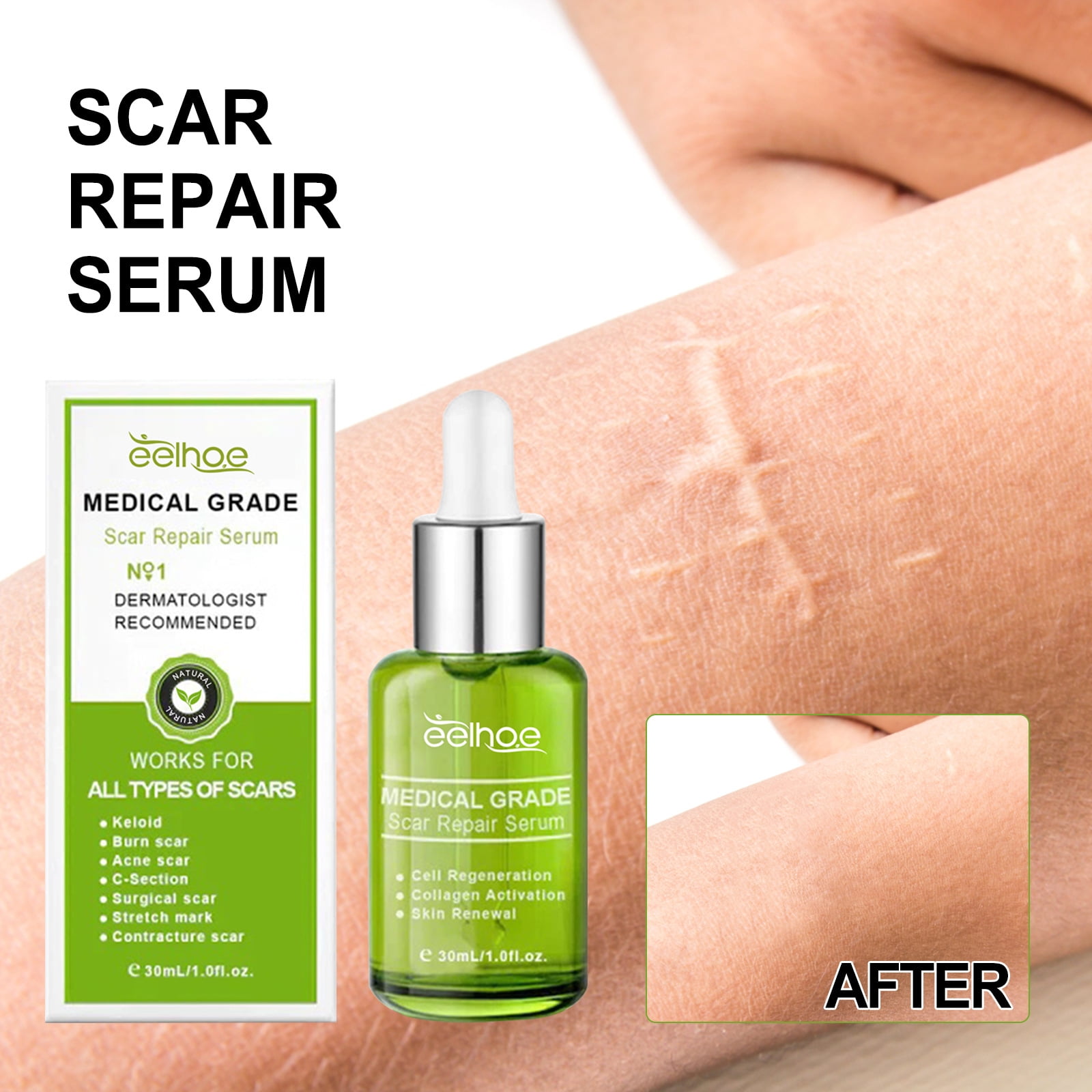 Pusili Scar Repair Serum,for All Types of Scars,Acne Scars,Belly Fat ...