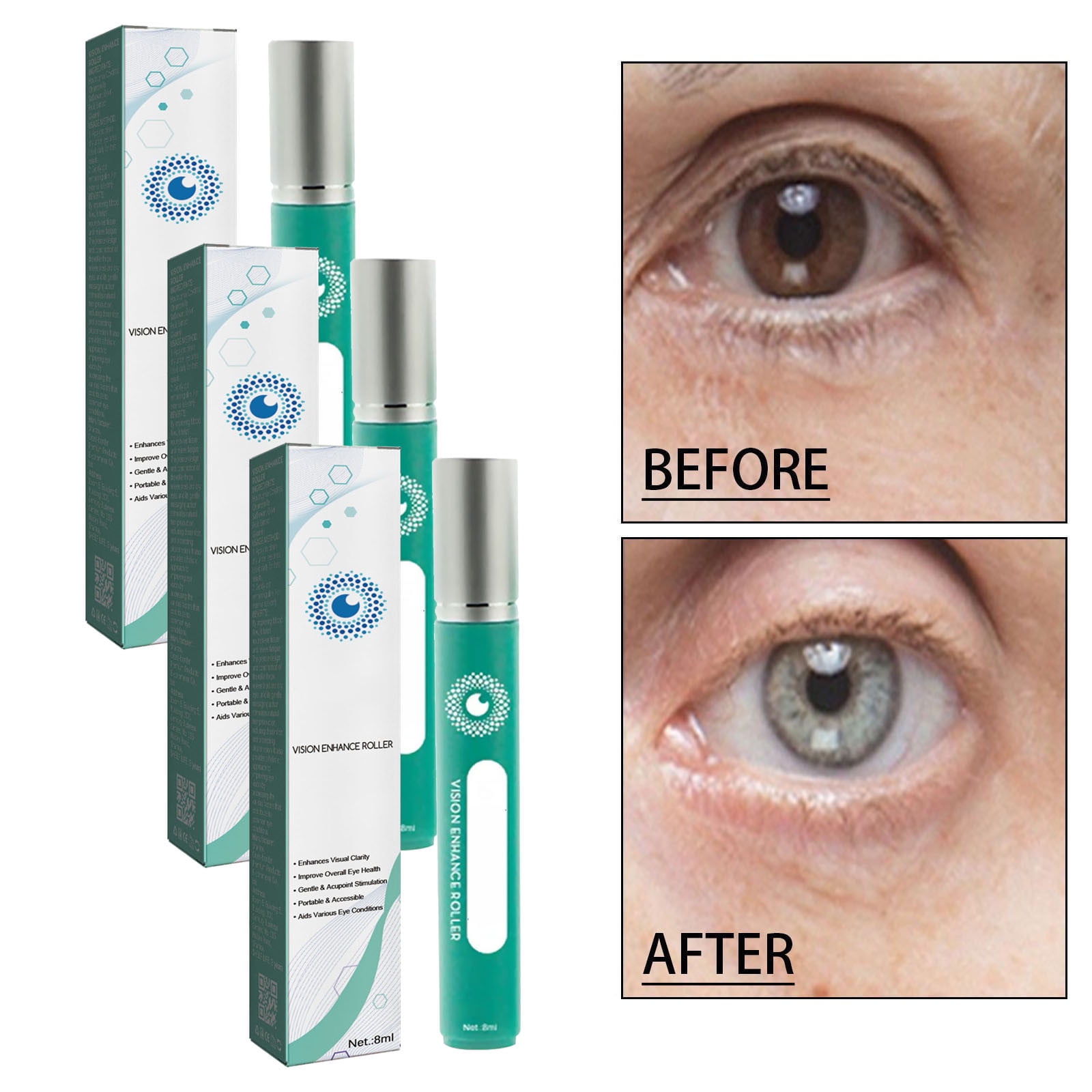 QIPOPIQ Vision Enhance Roller, Vision Enhance Roller for Puffy Eyes ...