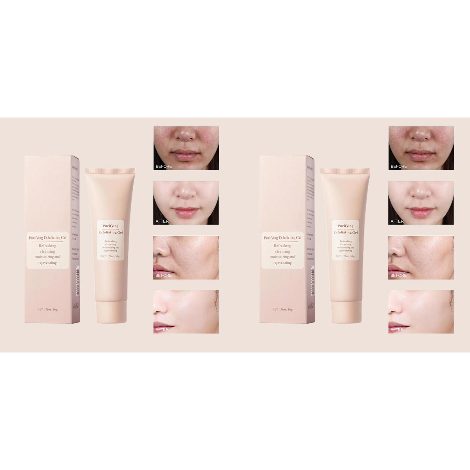 QUARXERY Purifying Exfoliating Gel, Exfoliating Scrub, QUARXERY Deep ...