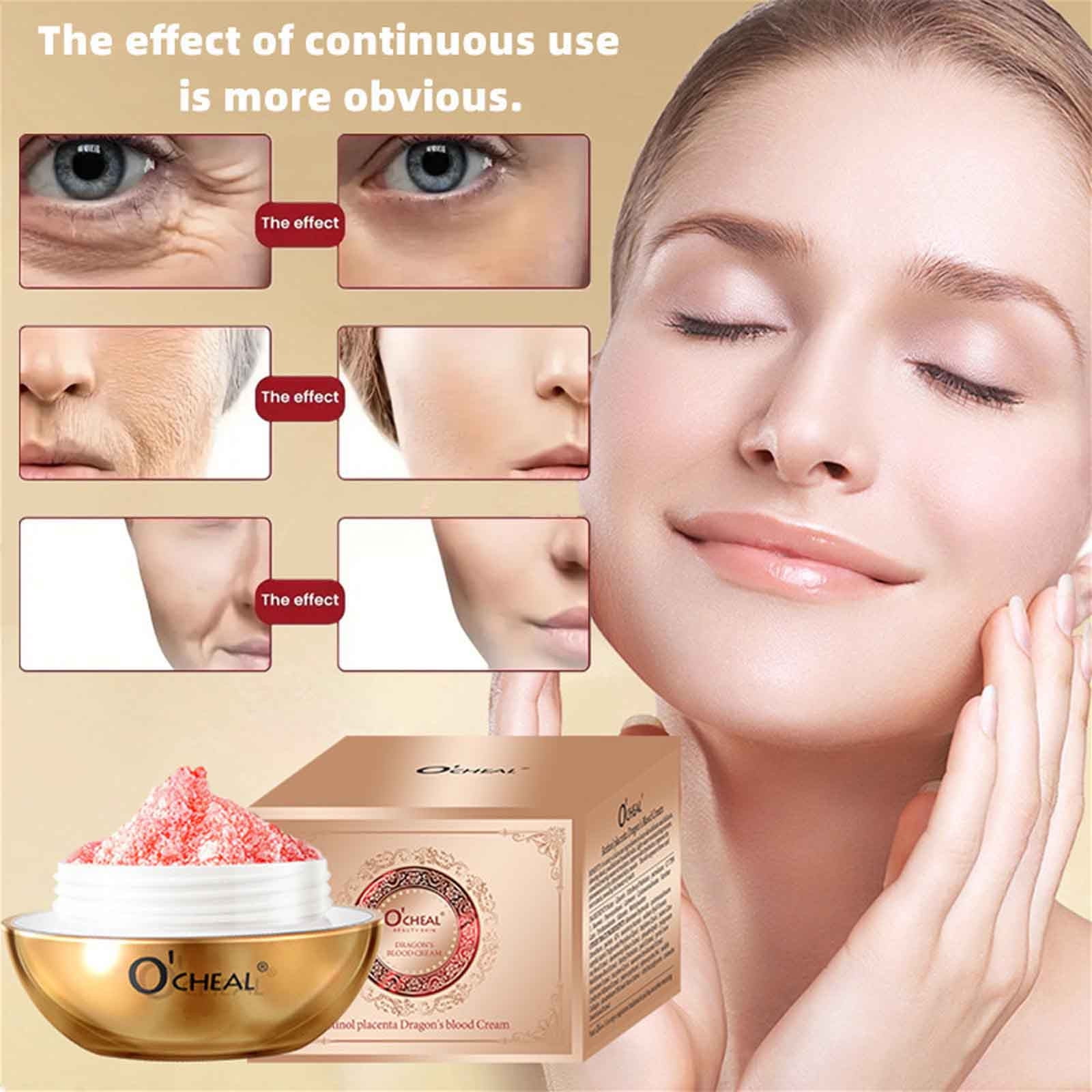 Qaailabf Retinol Placenta Anti-Aging Face Cream with Dragon's Blood Extract 50g - Skin Firming ...