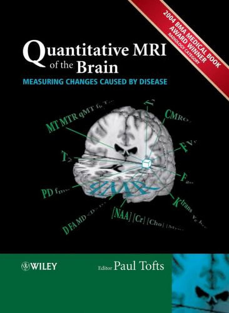 Pre-Owned Quantitative MRI of the Brain: Measuring Changes Caused by ...