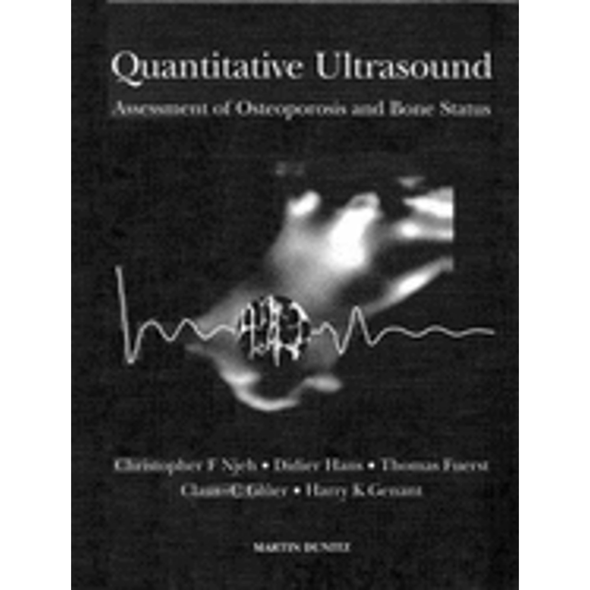 Quantitative Ultrasound: Assessment of Osteoporosis and Bone Status ...