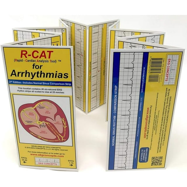 R-CAT for Arrhythmias EKG Pocket Reference Guide – Great Study Card for ...