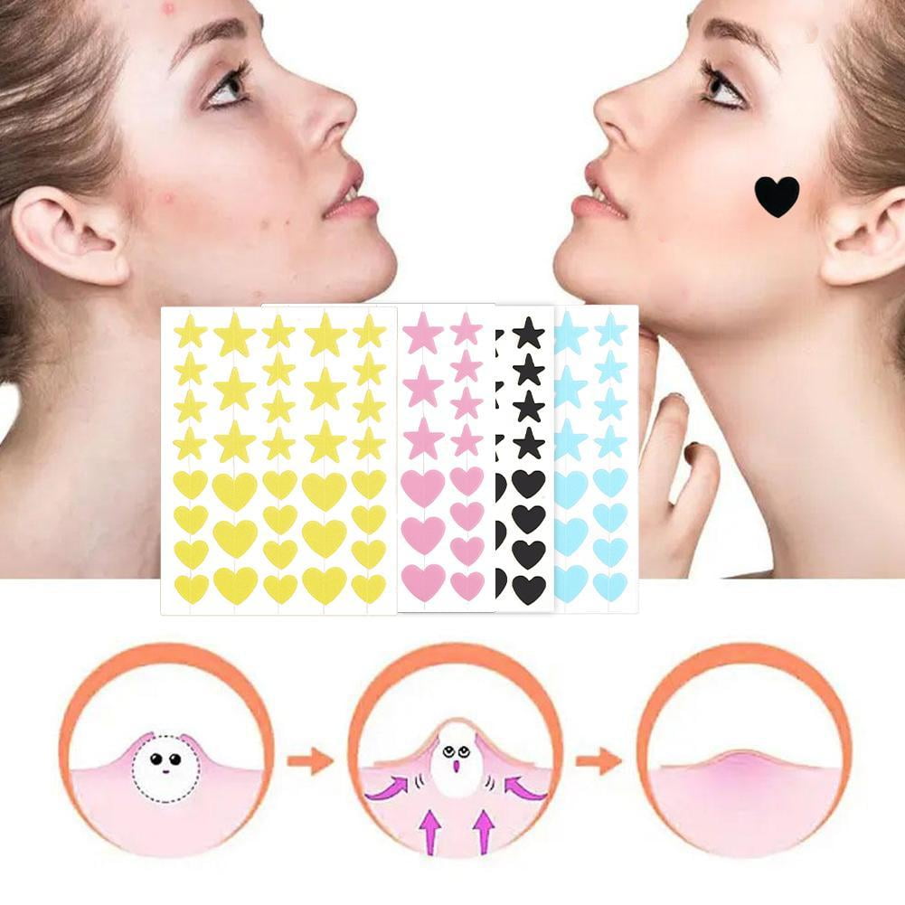 RUOYING 36PCS/Sheet Waterproof Salicylic Acne Stickers Pimple Remover ...