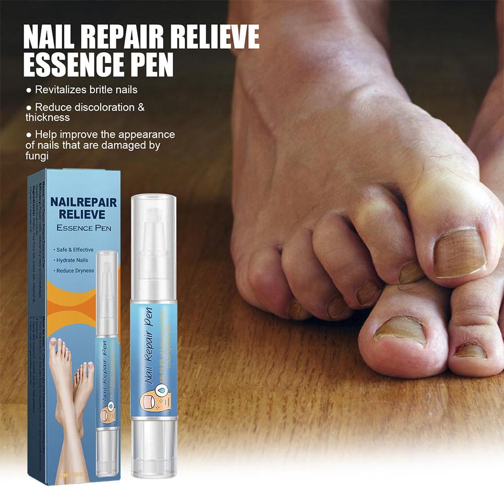 RUOYING Lanthome Anti Fungal Nail Treatment Finger Care Fungus Repair ...