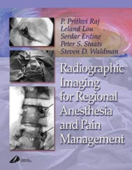 Pre-Owned Radiographic Imaging for Regional Anesthesia and Pain ...