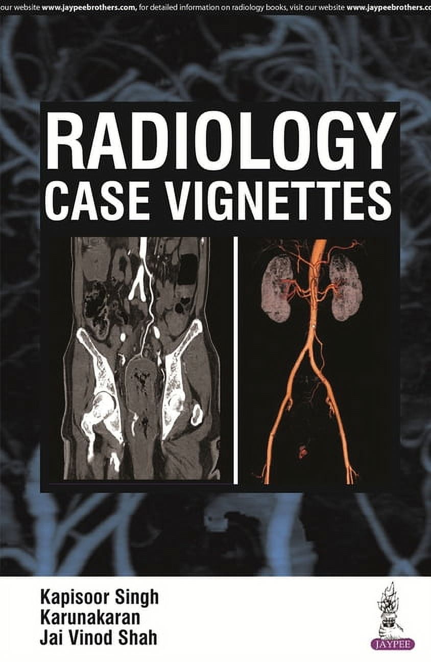 Radiology Case Vignettes (Paperback) - Walmart.com