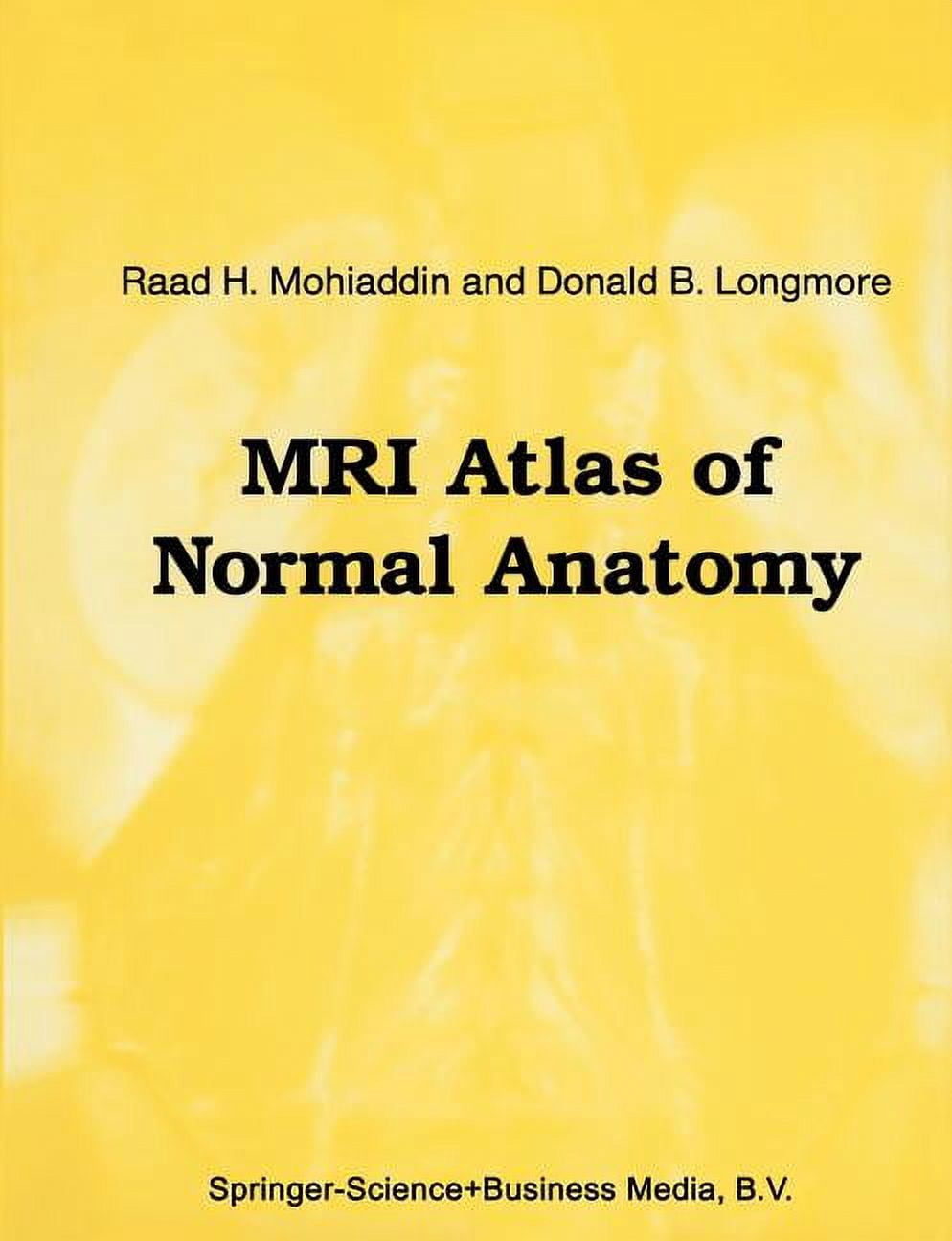 Radiology: MRI Atlas of Normal Anatomy (Paperback) - Walmart Business ...