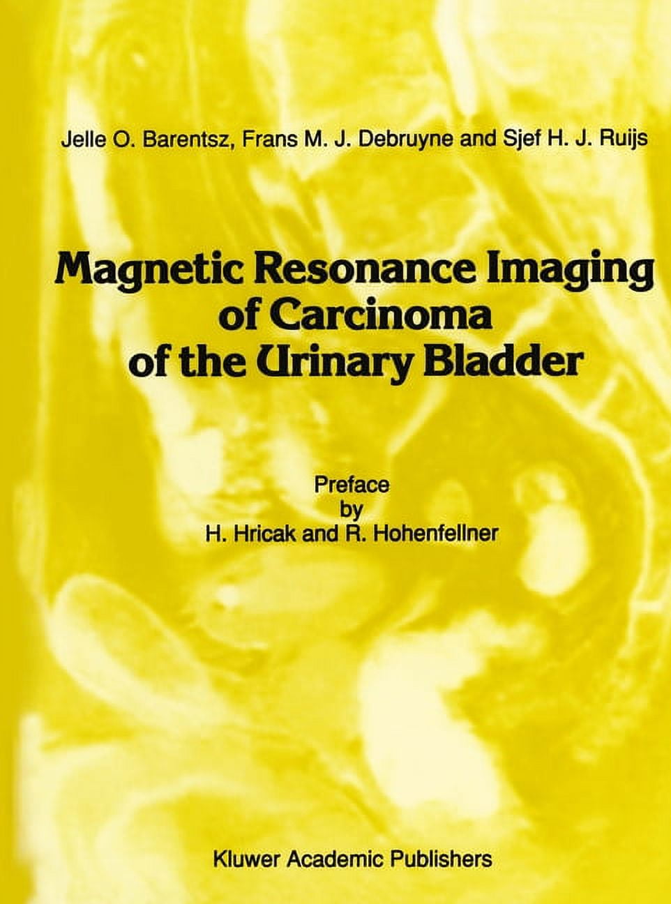 Radiology Magnetic Resonance Imaging of Carcinoma of the Urinary ...