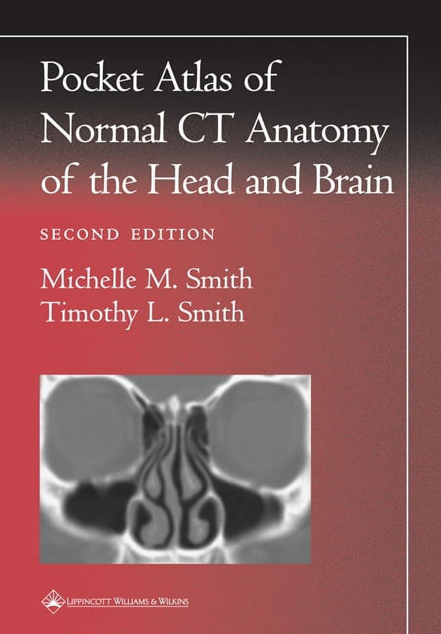 Radiology Pocket Atlas Pocket Atlas of Normal CT Anatomy of the Head ...