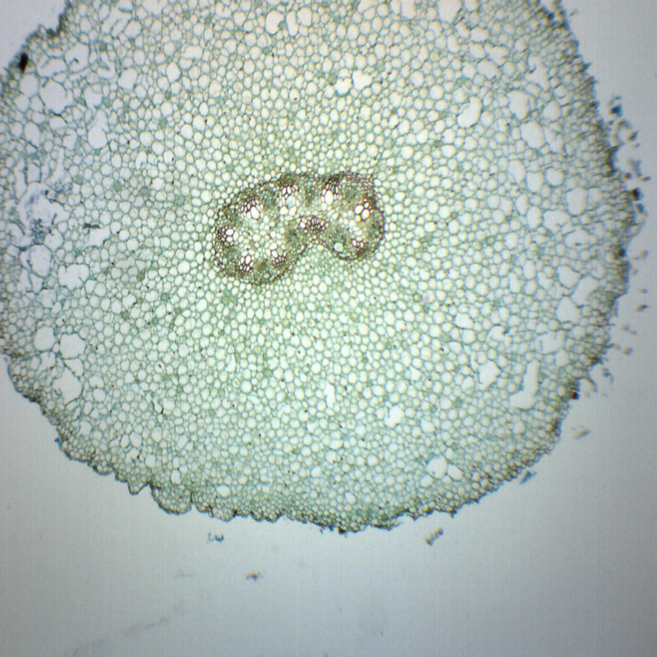 Ranunculus Young & Mature Root - Cross Section - Prepared Microscope ...