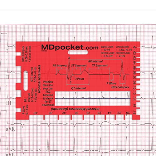 Rapid Id Ekg Intervals And Infarctions With Clear Window