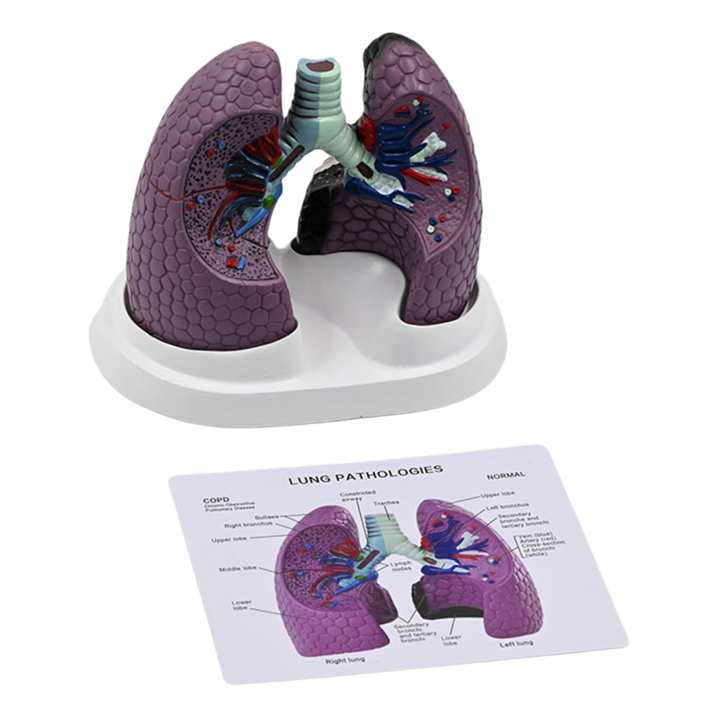Realistic Human Lung Anatomy Model Anatomical Lung Model Teaching Tool ...