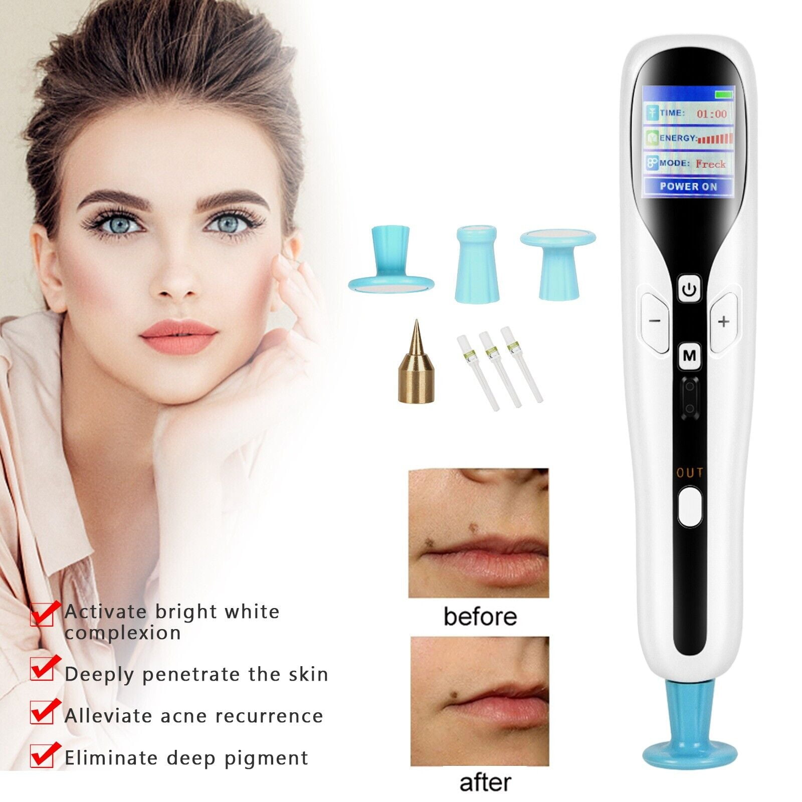 XYZdreams 2-in-1 Anti-Aging Laser P-lasma Skin Spot Remover, 1-Piece ...