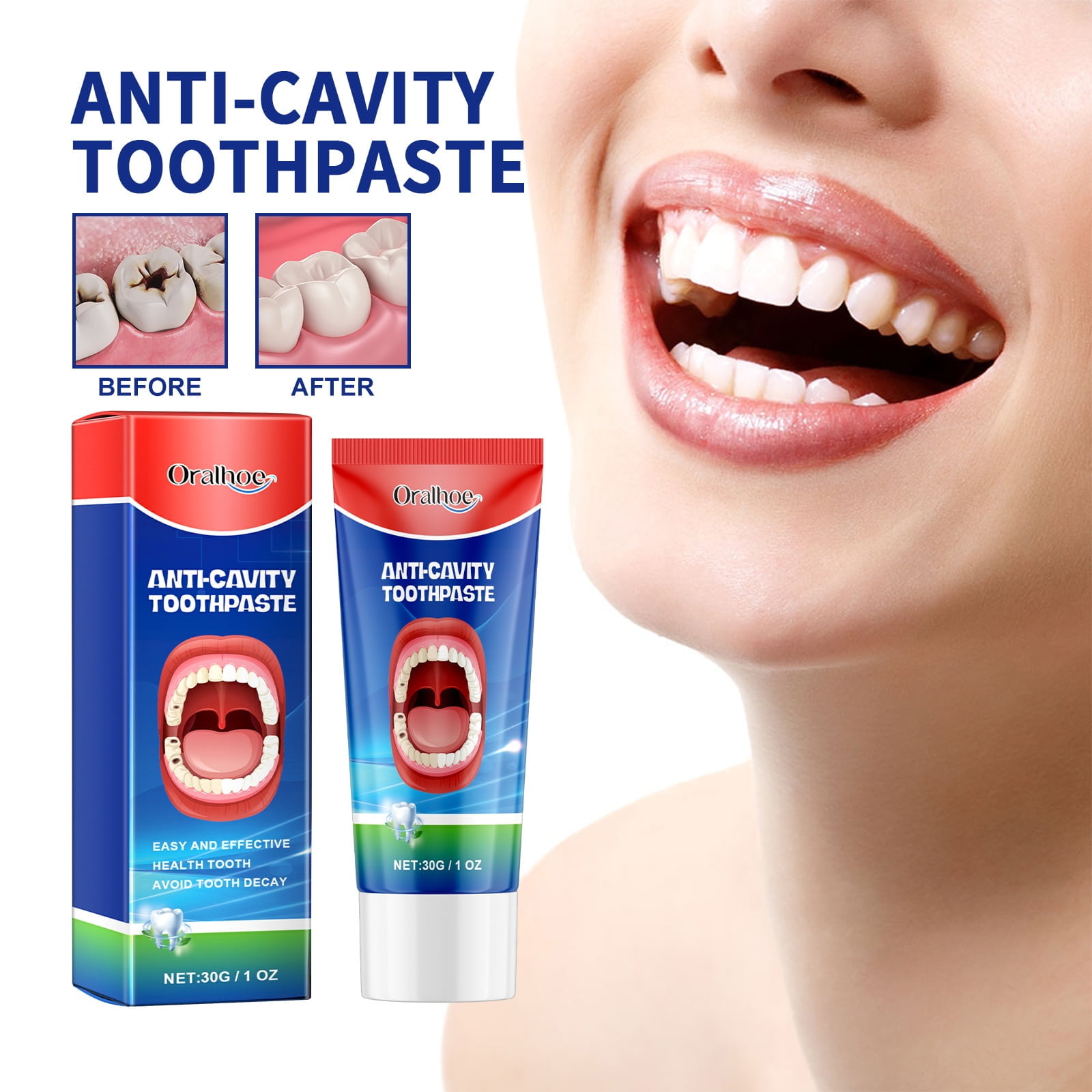 Reduce Caries Toothpaste for Oral Care, Cleans Yellowing Teeth ...