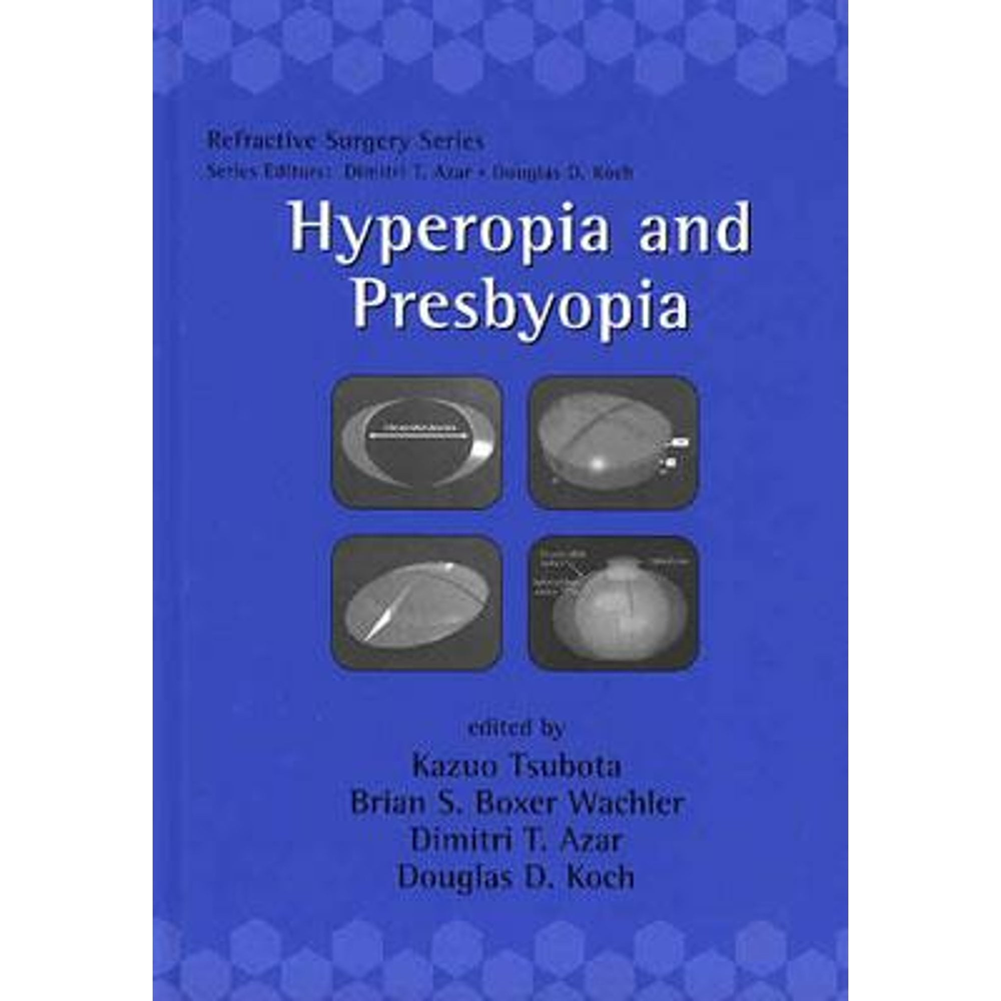 Pre-Owned Hyperopia and Presbyopia (Hardcover) by Kazuo Tsubota, Brian ...