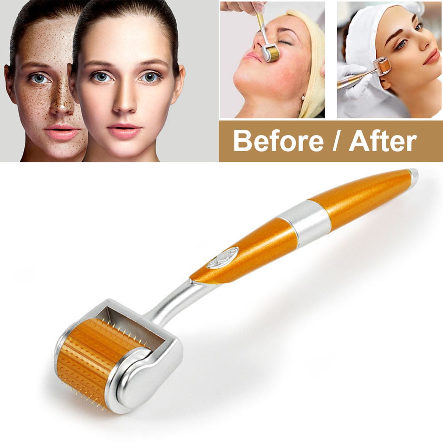 Regen Premium Derma Roller for face Titanium Microdermabrasion 192 ...