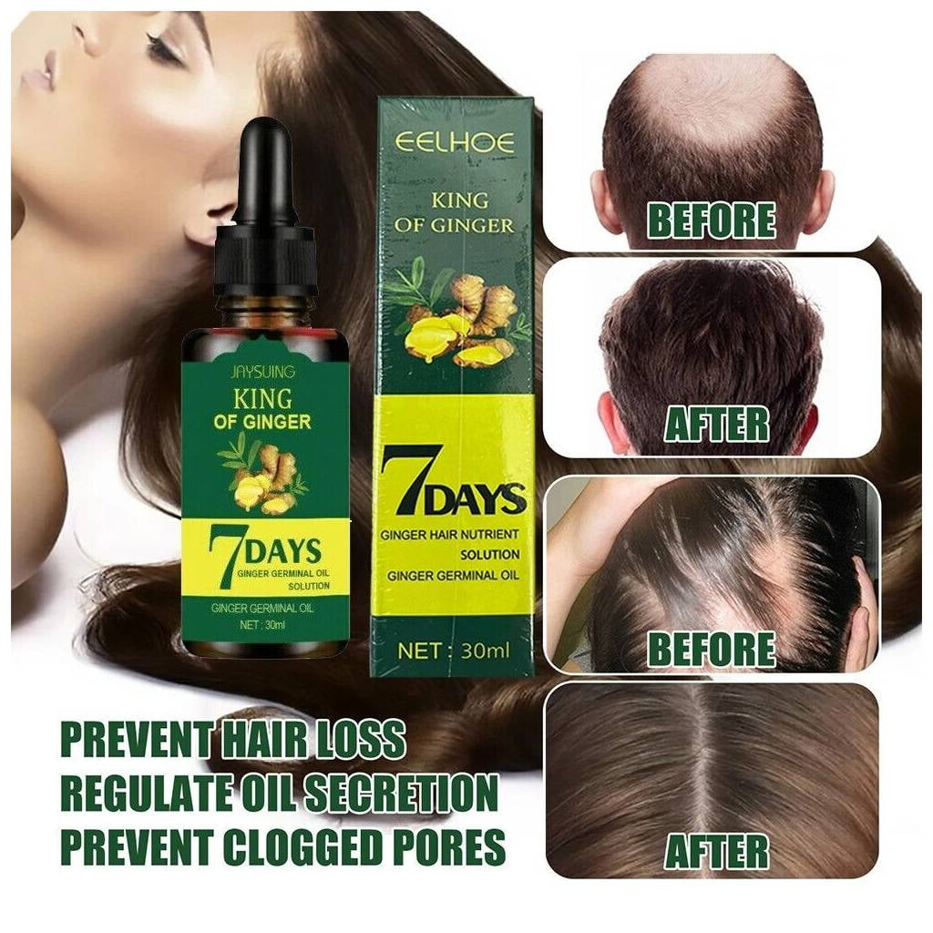 Regrow 7 Day Ginger Germinal Hair Growth Serum Hairdressing Oil Loss