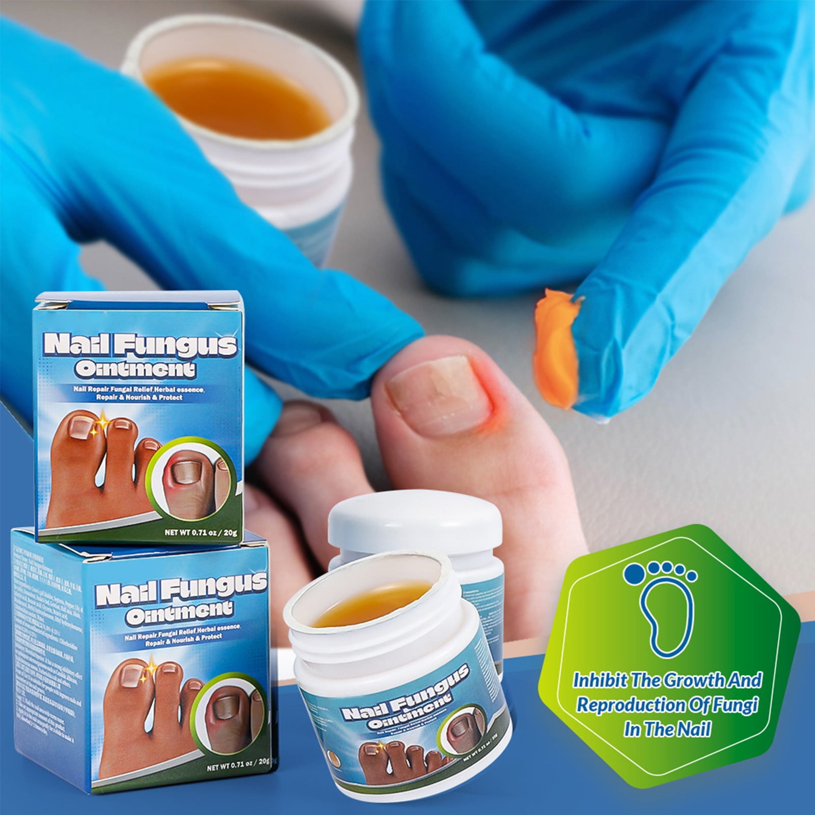 Rehabilitation Cream For Paronychia, Nail And Toenail Care Cream, Nail ...