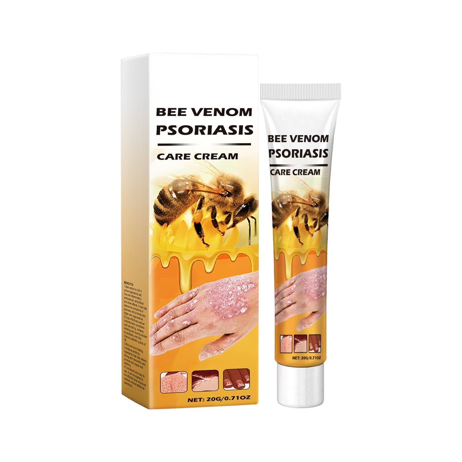 Relief For Skin Irritations,External Use Of To Tinea Manus And Feet ...