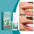 Remineralization Gel Tooth Remineralization Cordless Water Pick ...