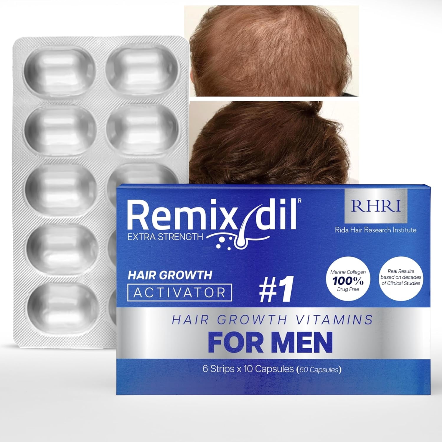 Hair Growth Vitamins Hair Regrowth For Men Supports Beard And Scalp ...