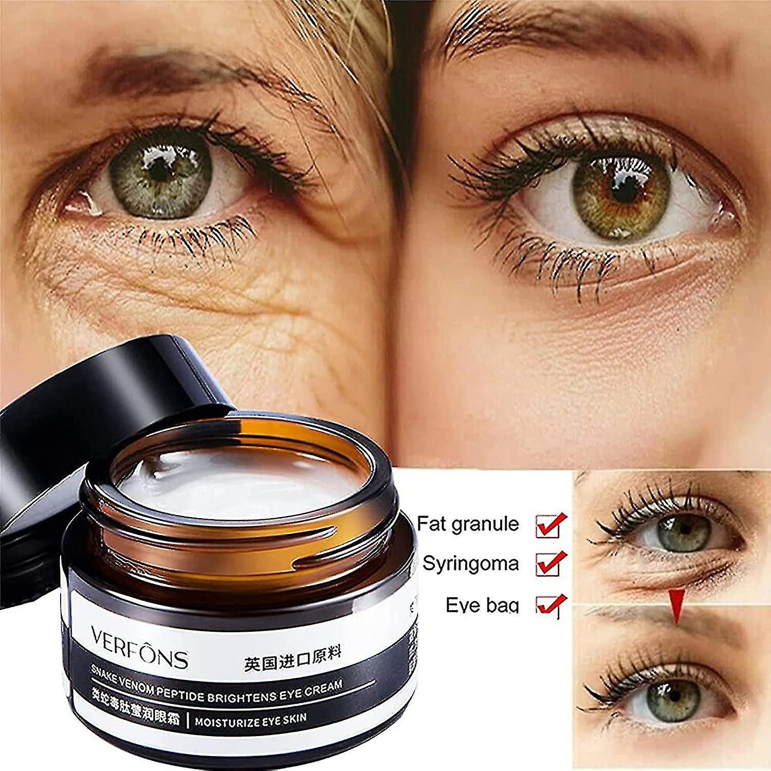 Removal Eye Bags Cream, Retinol Cream, Anti-puffiness Care - Walmart.com