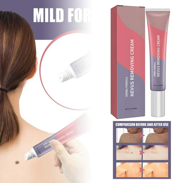 Removal Skin Cleansing And Wart Hand Foot Face Armpit Neck Soft Remover