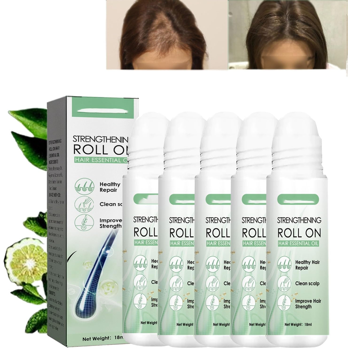 Renew Hair X Roll-On Hair Treatment,Renewhair X Hair And Beard Regrowth ...