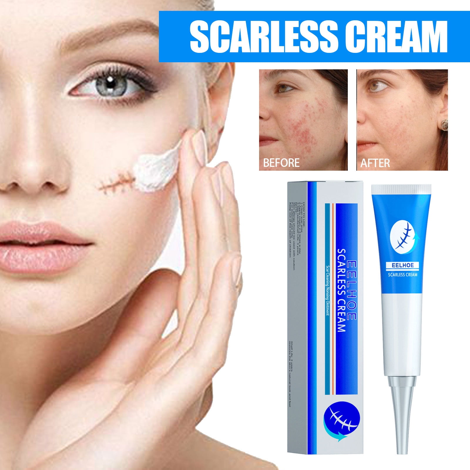 Repair skin, lighten scars, smooth skin, remove scars from pregnancy ...