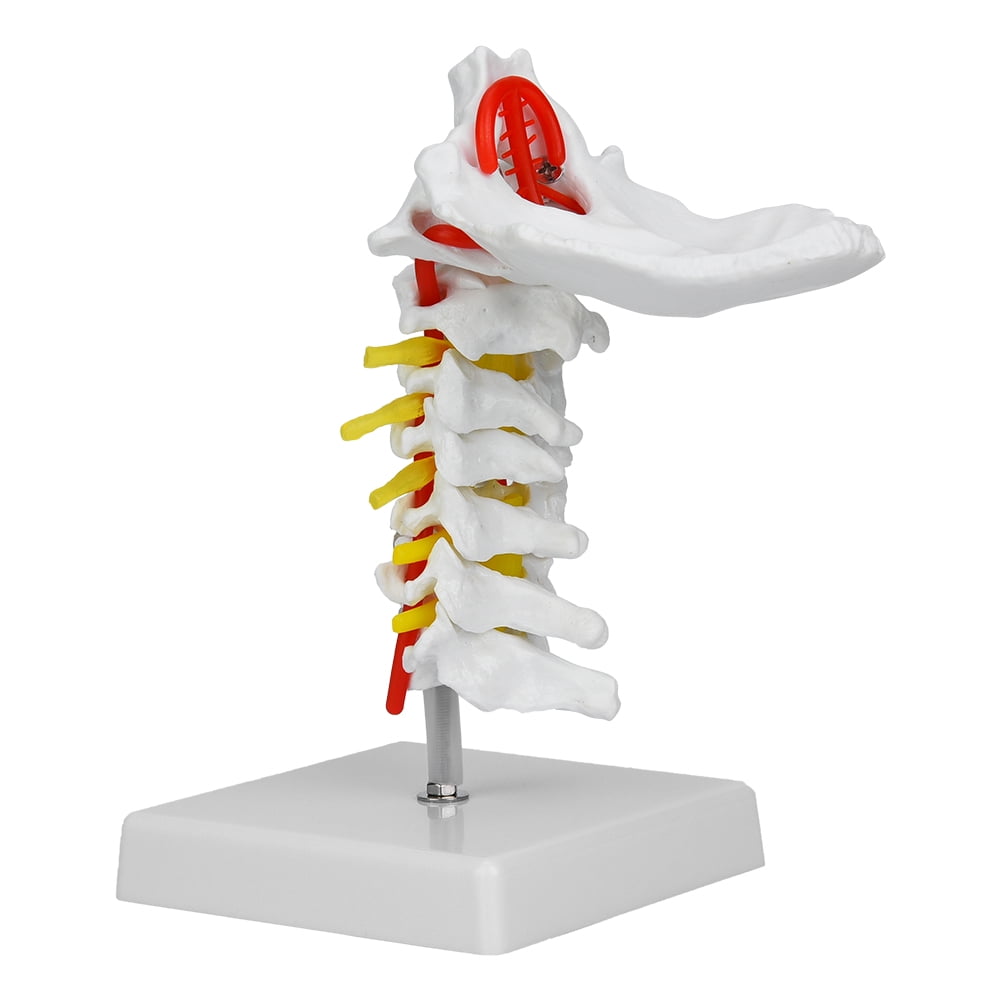 Restore Details Cervical Vertebra Model, Detailed Description Spinal ...