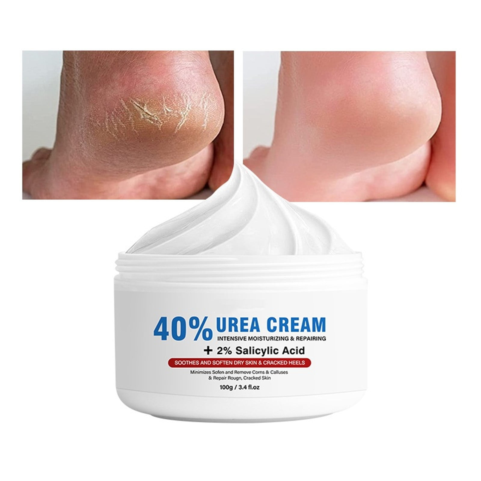 Retinol Body Lotion 40% Moisturizing Hand And Foot Drying And ...