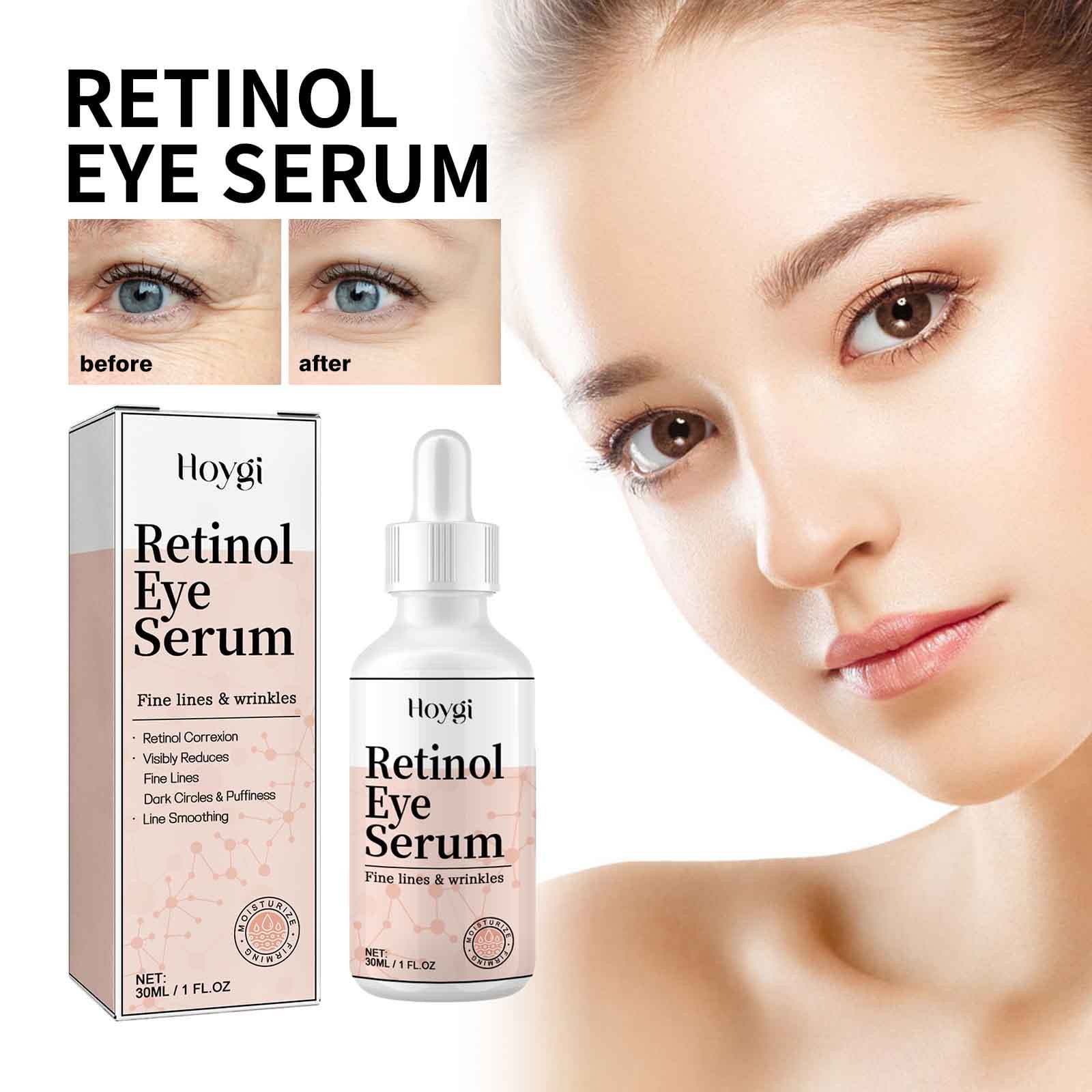 Retinol Eye Serum for Dark Circles & Wrinkles | Under Eye Treatment ...