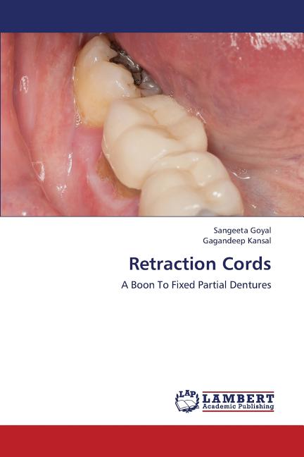 Retraction Cords (Paperback) - Walmart.com