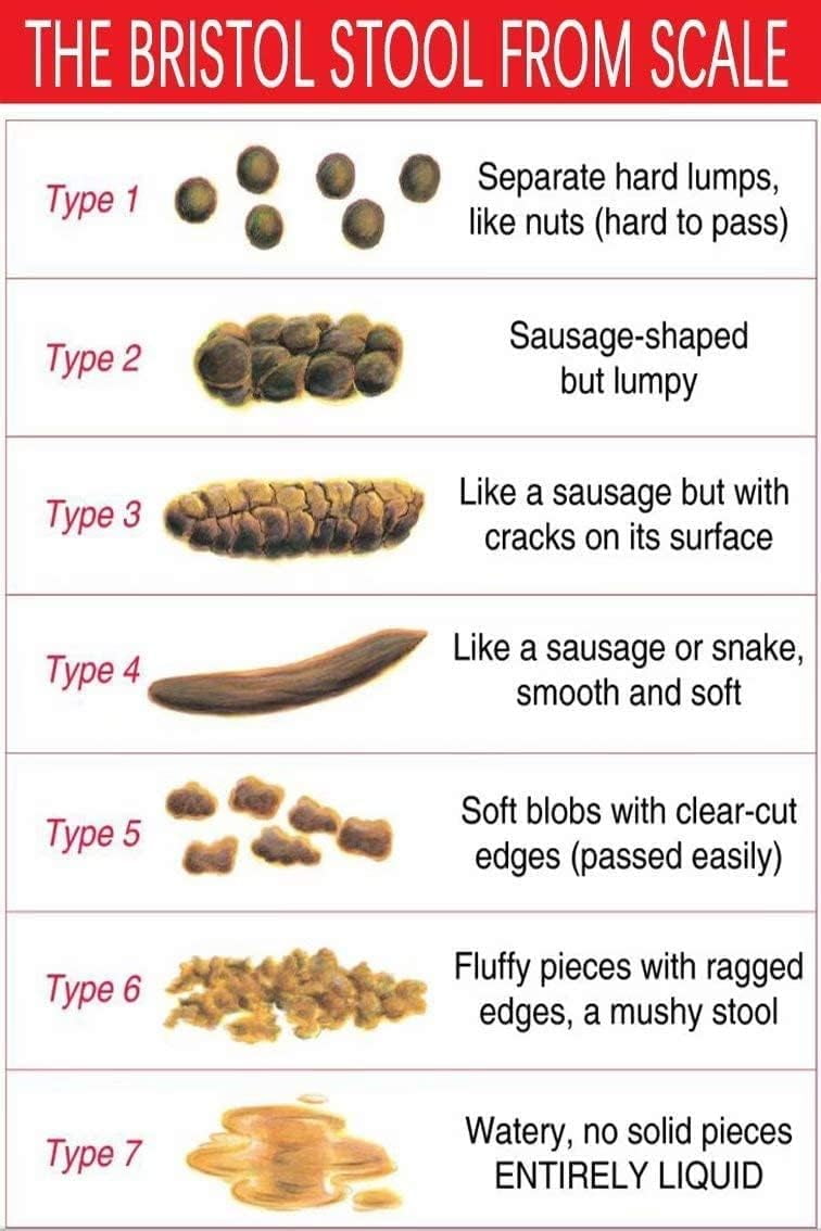 Retro Metal Sign Bristol Stool Chart Poop Wall Decor Toilet Health ...