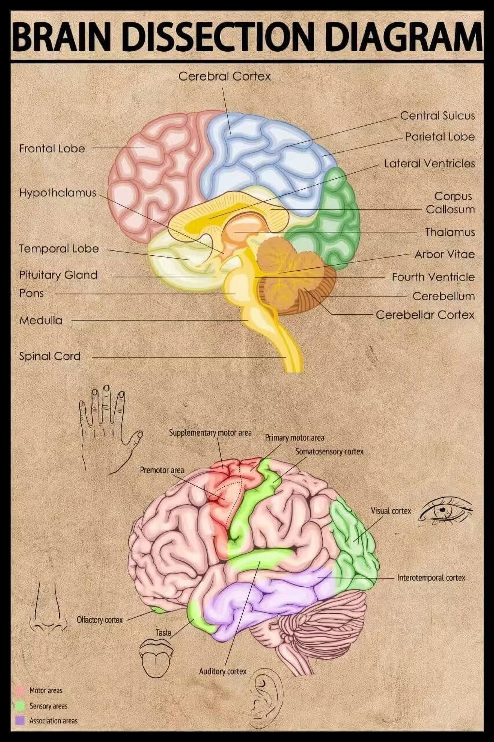 Retro Tin Sign Brain Knowledge Drain Dissection Diagram Hospital ...