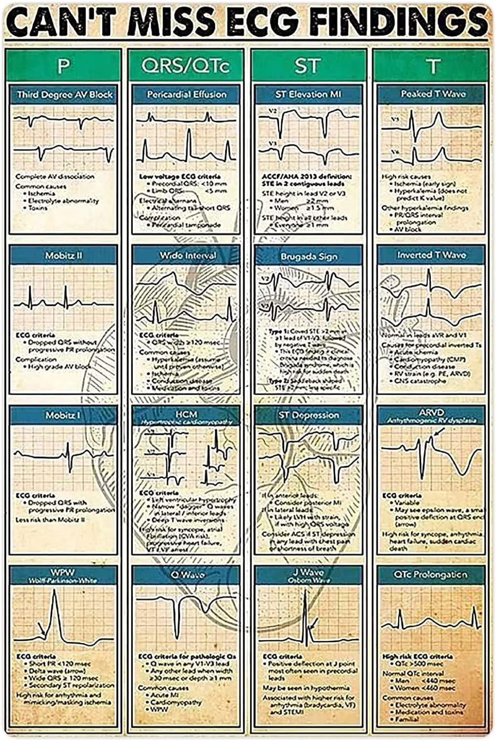 Retro Tin Sign ECG Knowledge Can't Miss ECG Findings Cardiologists ...