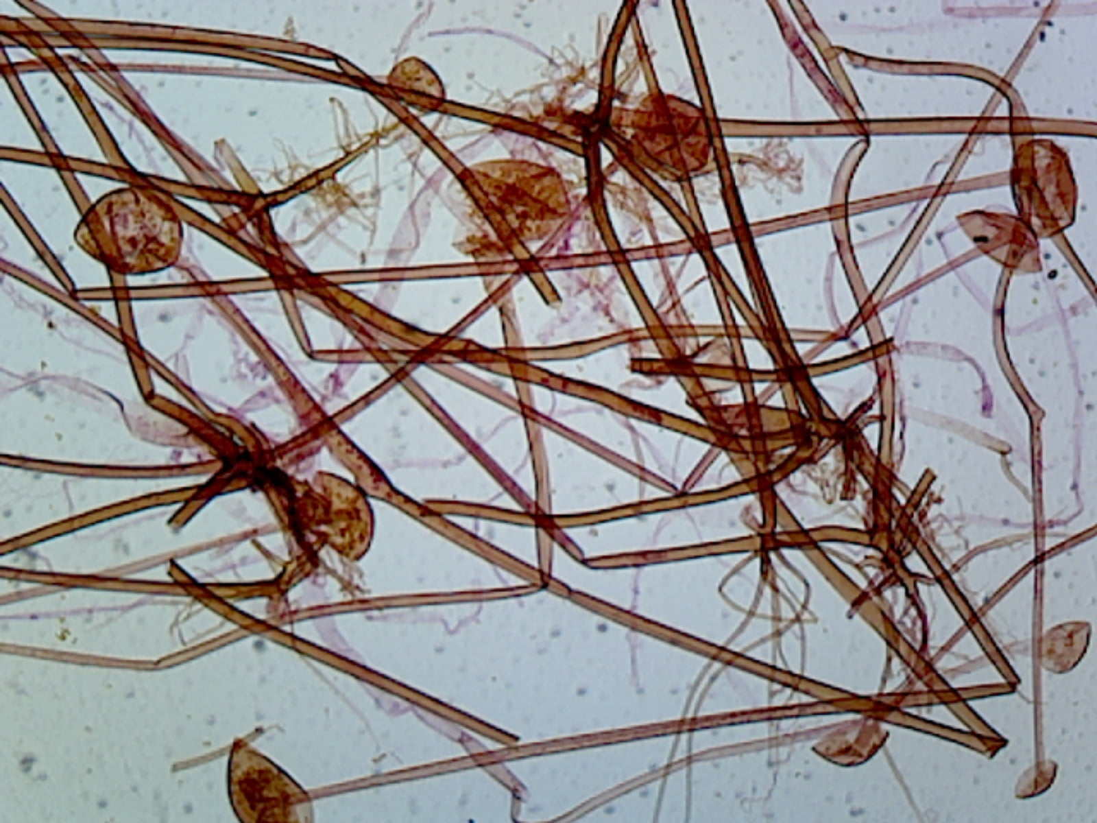 Rhizopus Under Microscope