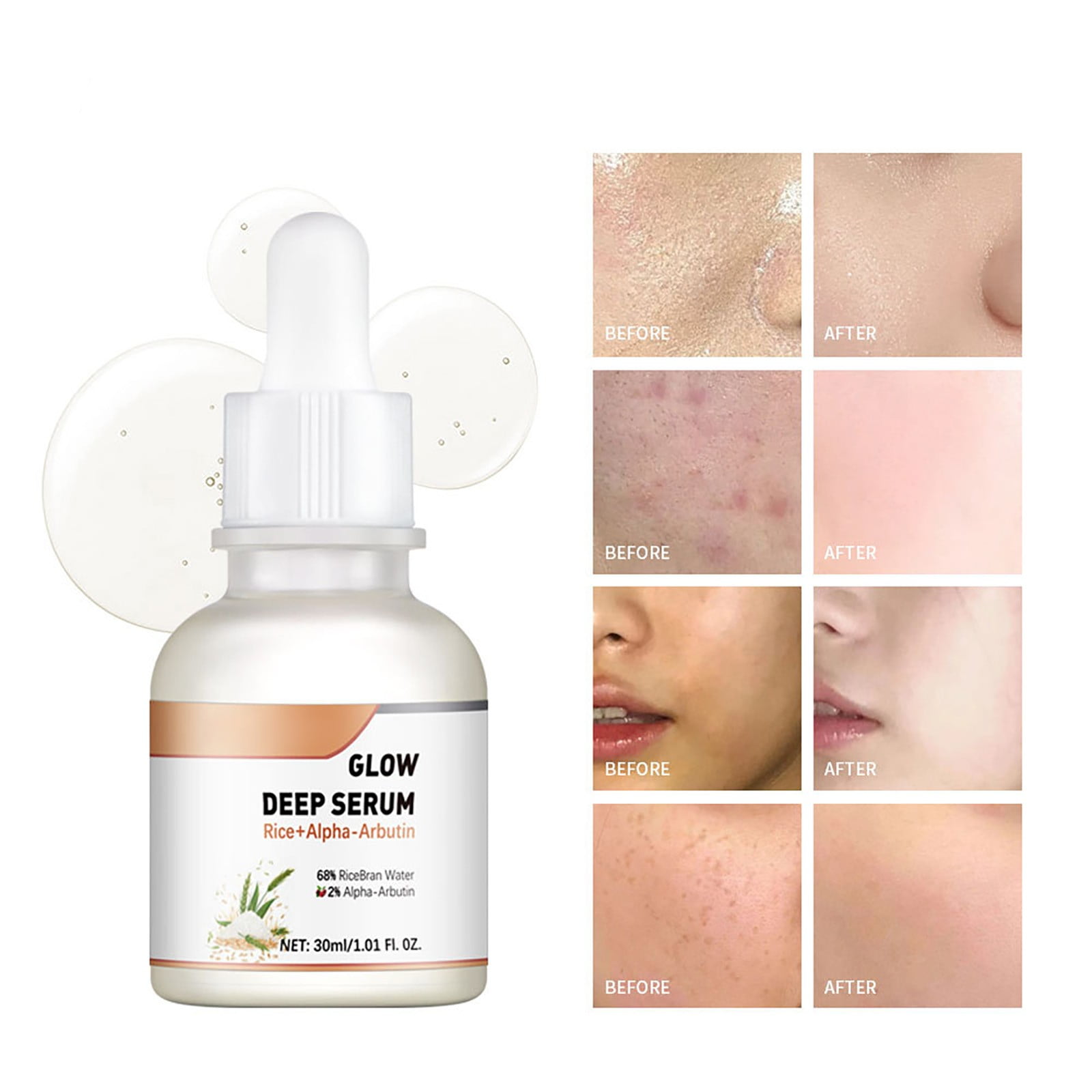 Rice Α Arbutin Facial Moisturizing Marine Extract Arbutin Fades
