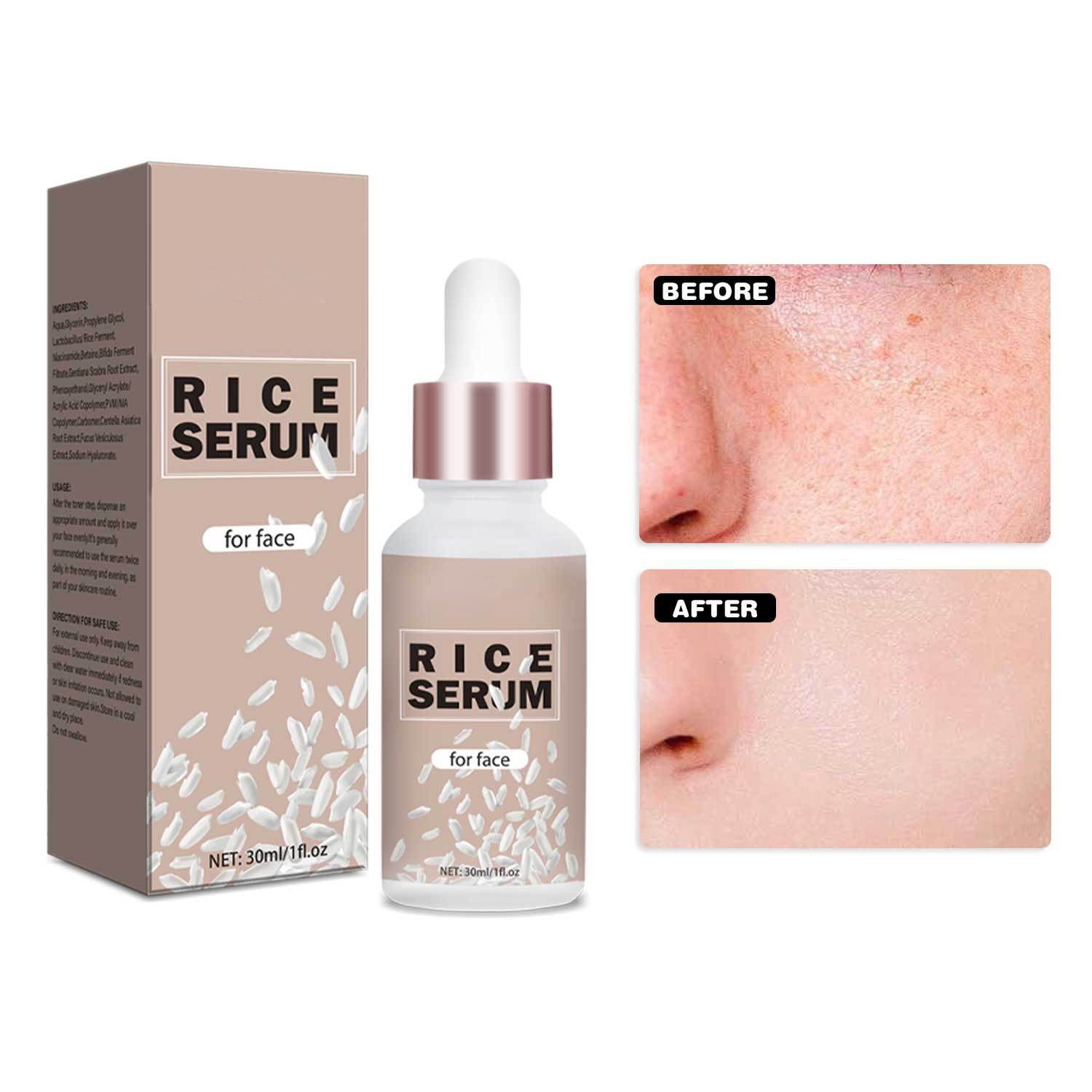 Rice Face Serum Hydrating and Nourishing Formula Replenishes Moisture ...